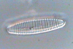 Bacillariophyceae (Diatoms) – Paul Westerhoff