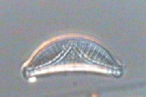 Bacillariophyceae (Diatoms) – Paul Westerhoff