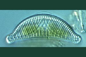 Bacillariophyceae (Diatoms) – Paul Westerhoff