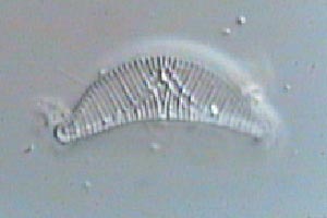 Bacillariophyceae (Diatoms) – Paul Westerhoff