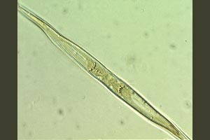 Bacillariophyceae (Diatoms) – Paul Westerhoff