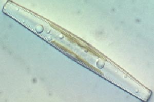 Bacillariophyceae (Diatoms) – Paul Westerhoff