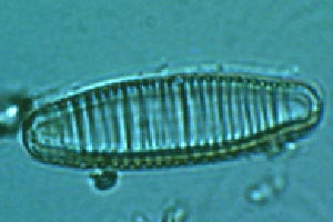 Bacillariophyceae (Diatoms) – Paul Westerhoff